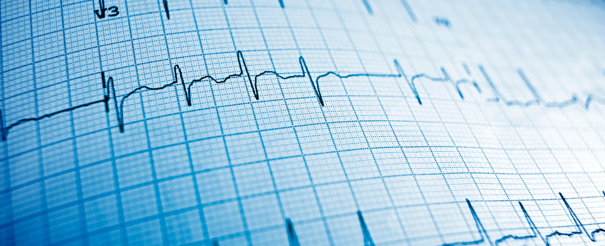 Excaliper – Hone Your EKG Skills